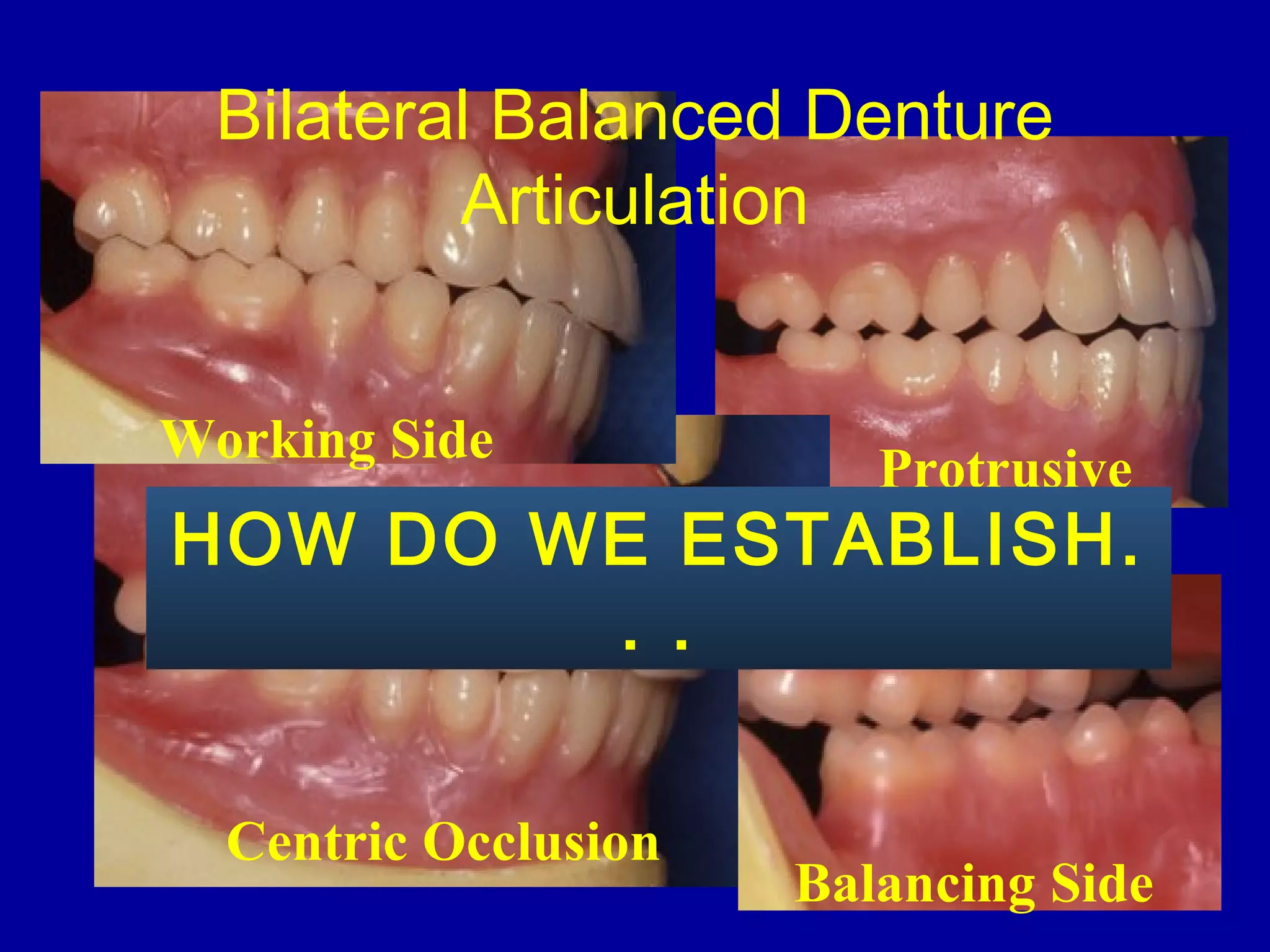 10. posterior teeth arrangement | PPT