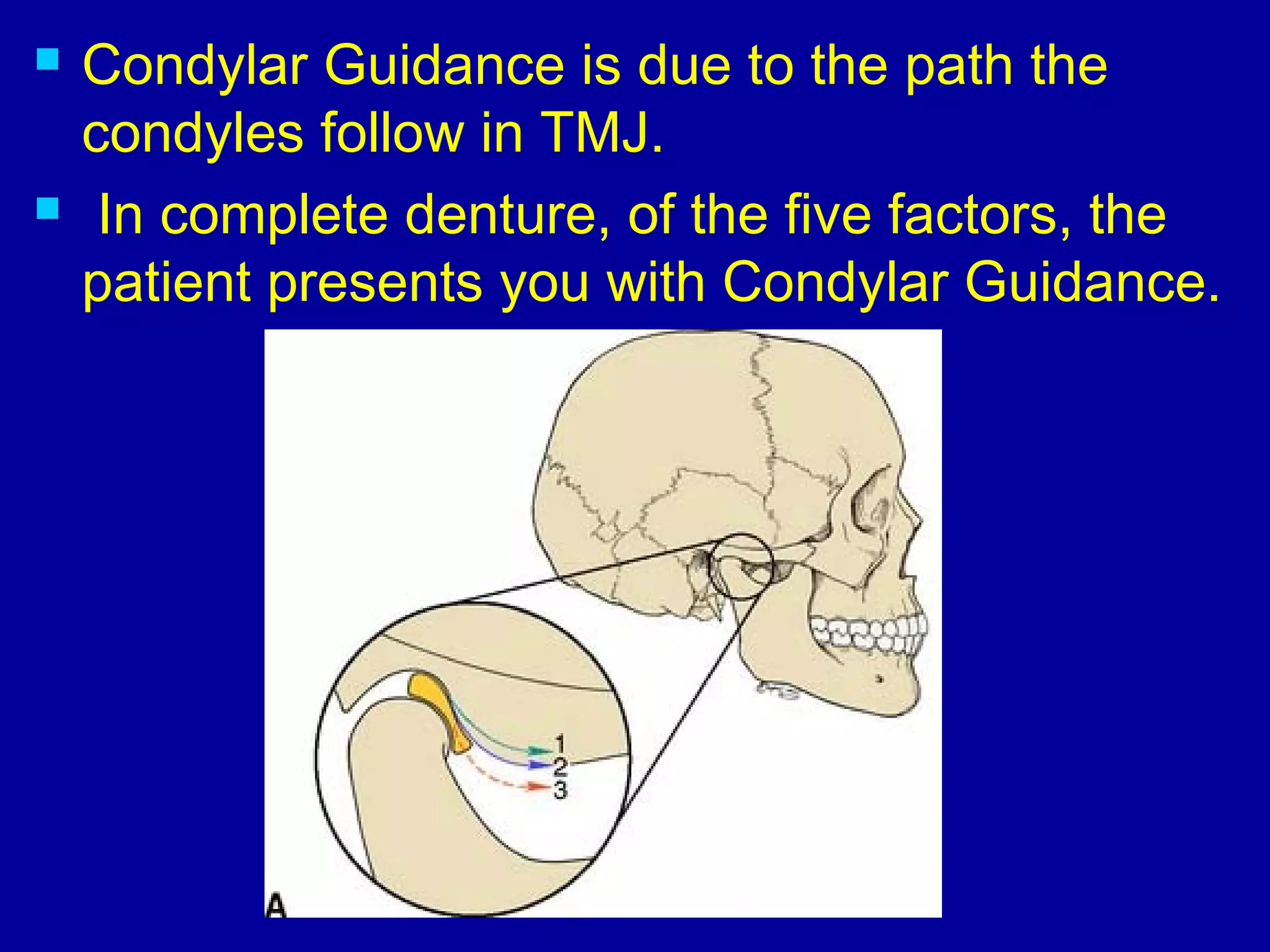 10. posterior teeth arrangement | PPT