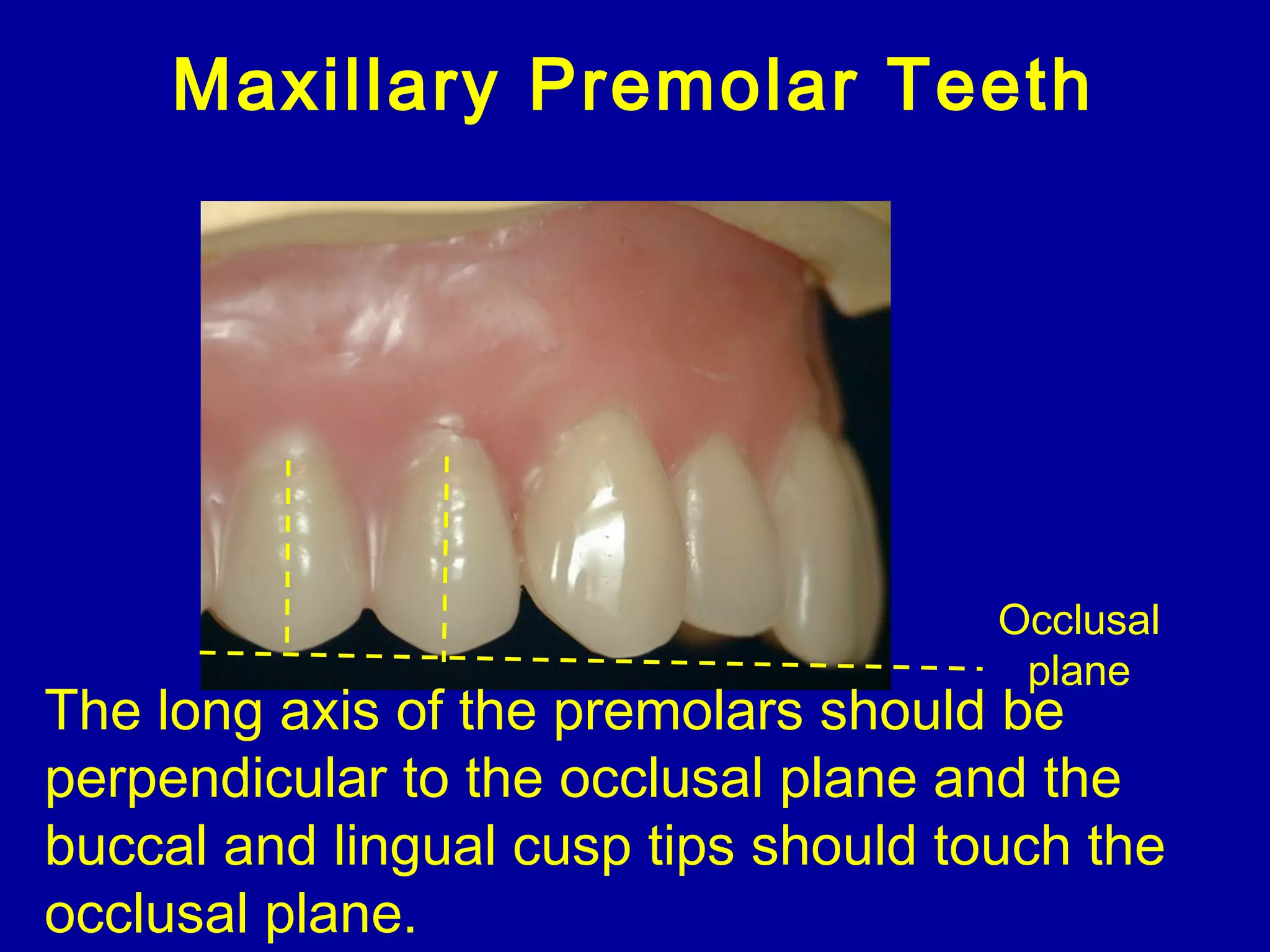 10. posterior teeth arrangement | PPT