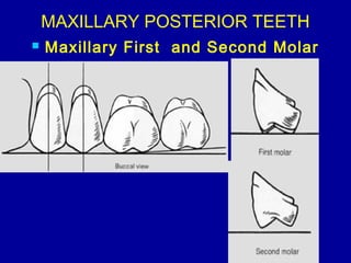 10. posterior teeth arrangement | PPT