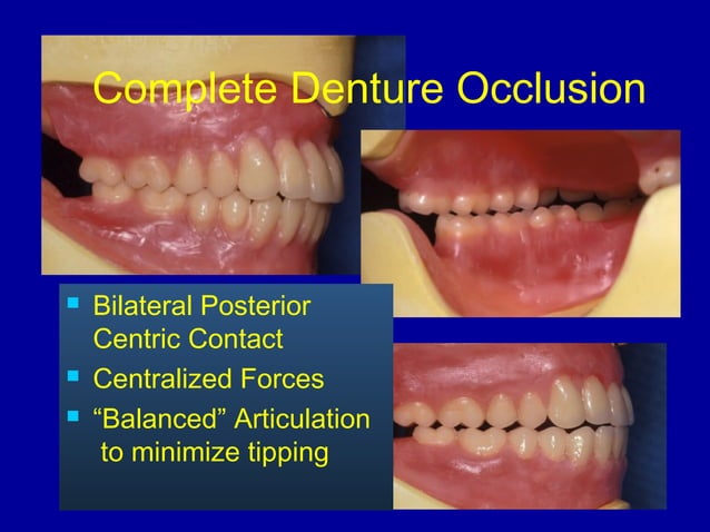 10. posterior teeth arrangement