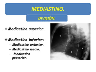 Mediastino | PPTX