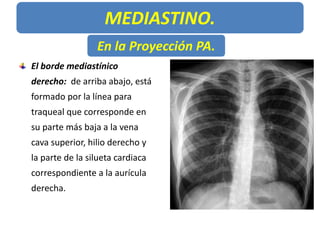 Mediastino | PPTX