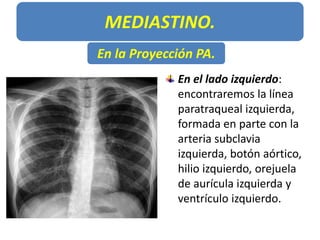 Mediastino | PPTX