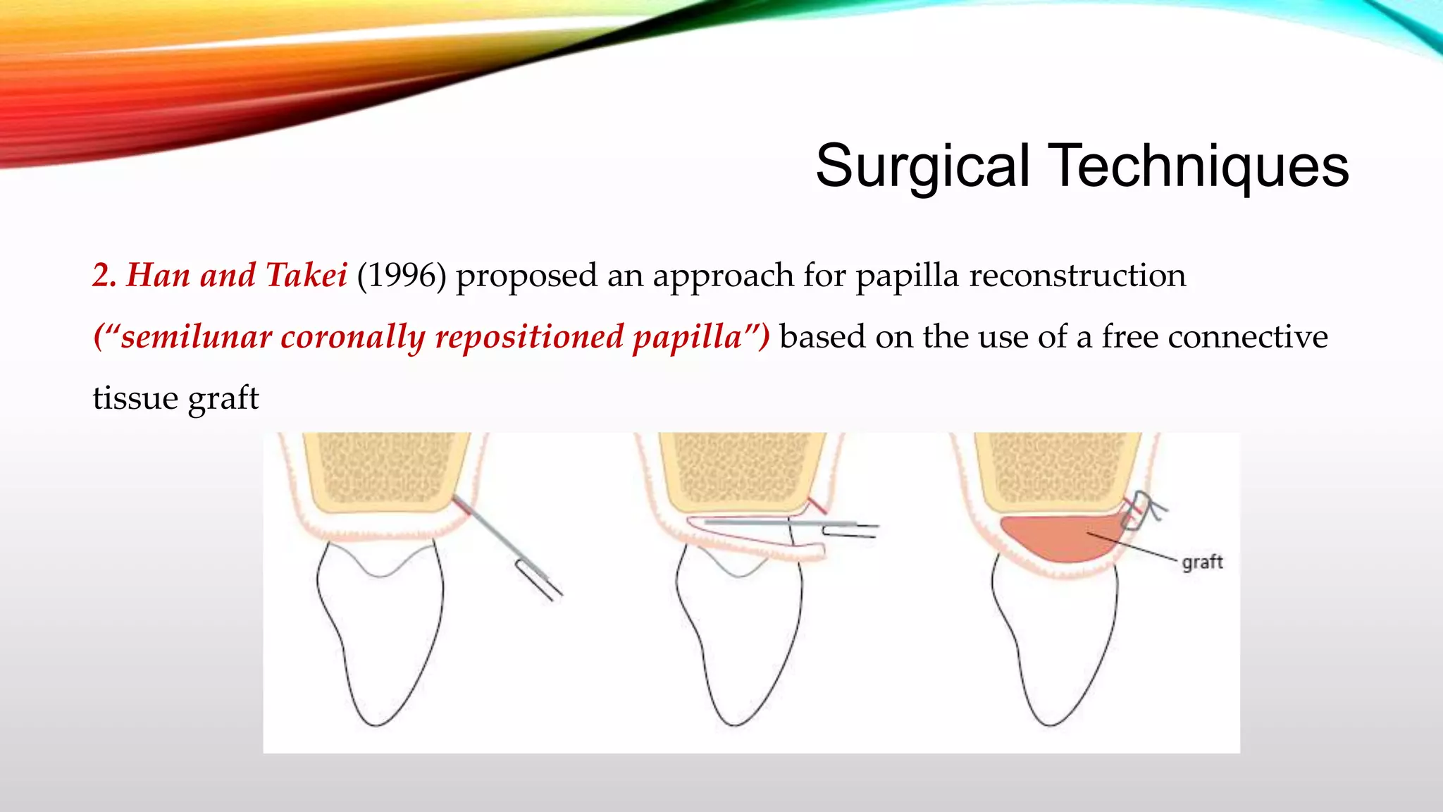 Perio esthetics | PPTX