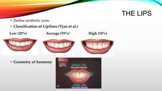 Perio esthetics | PPTX