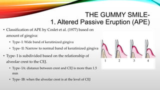 Perio esthetics | PPTX