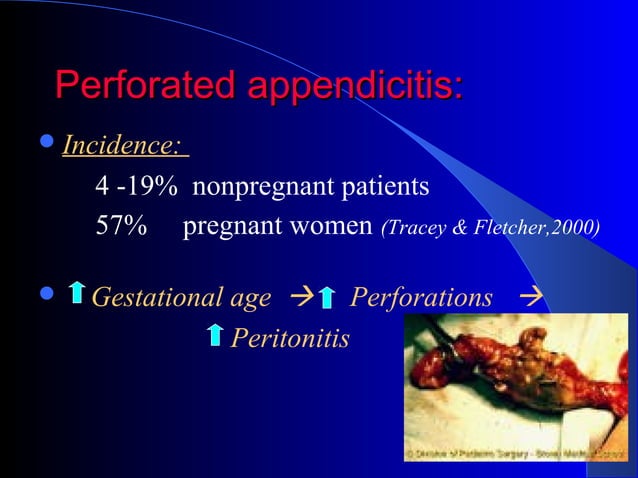 Appendicitis during pregnancy | PPT | Pregnancy | Reproductive Health