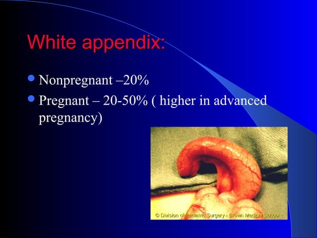Appendicitis during pregnancy | PPT | Pregnancy | Reproductive Health