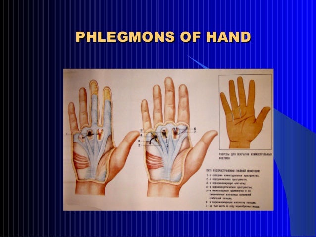 Surgical Infection. Acute purulent infection of skin & cellular spases