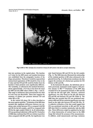 mandibular condyle position comparison of articulator mountings and ...