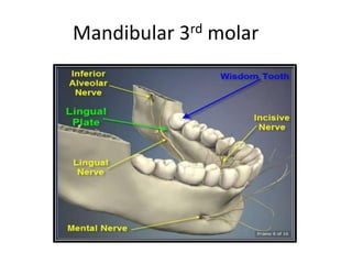 THIRD MOLAR IMPACTION (BASIC) | PPTX