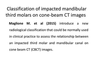 THIRD MOLAR IMPACTION (BASIC) | PPTX