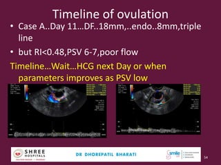PCOS - Ovulation Induction 1 - Dr Bharati Dhorepatil | PPTX