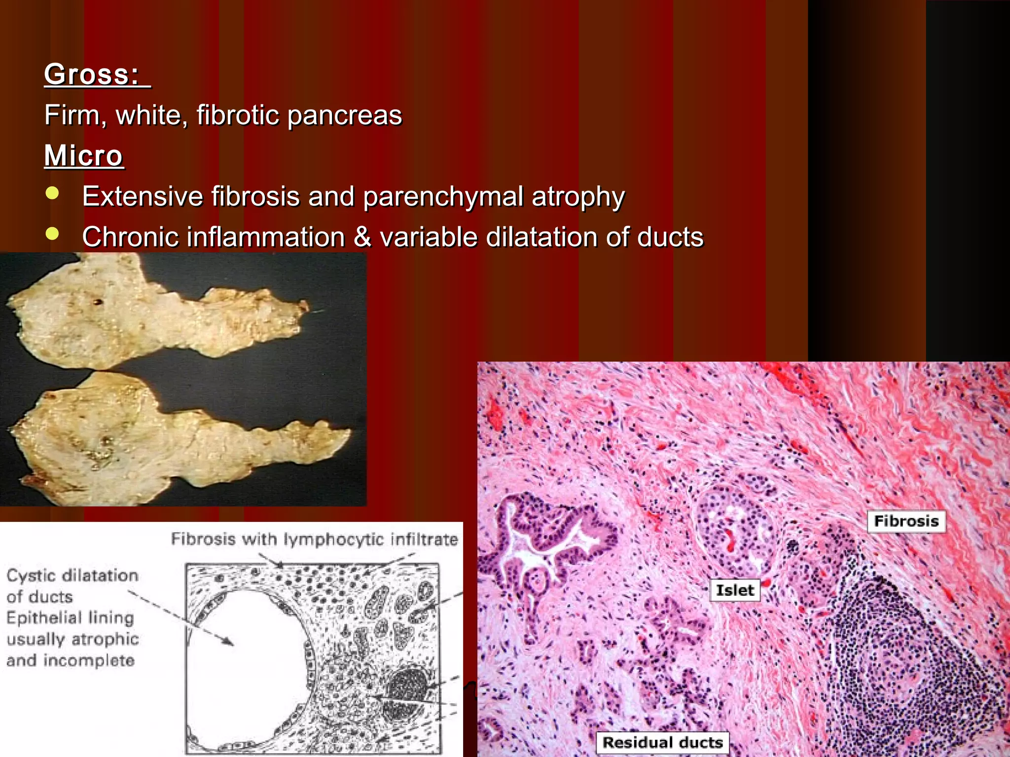 10.pancreatic pathology | PPT