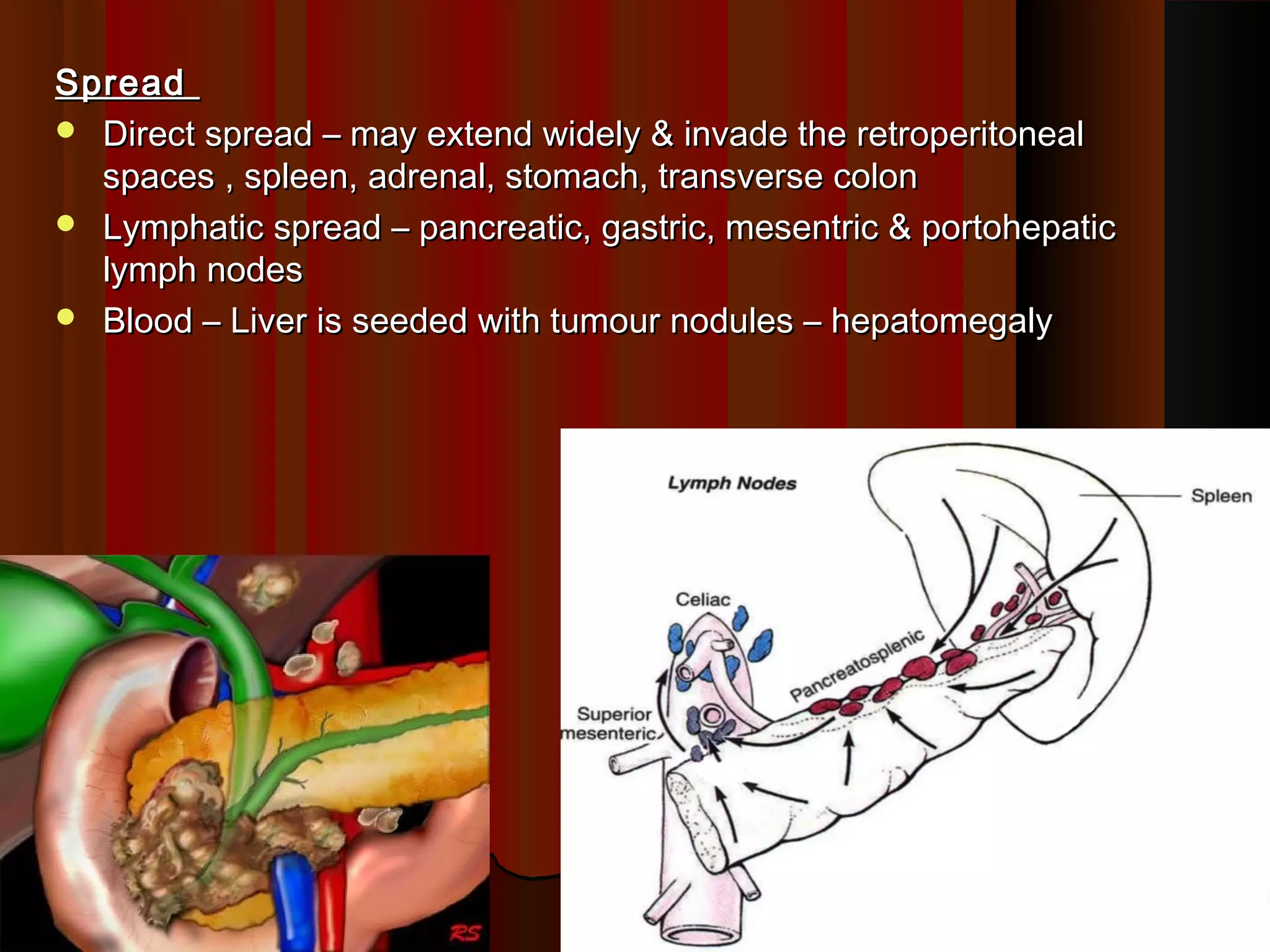10.pancreatic pathology | PPT