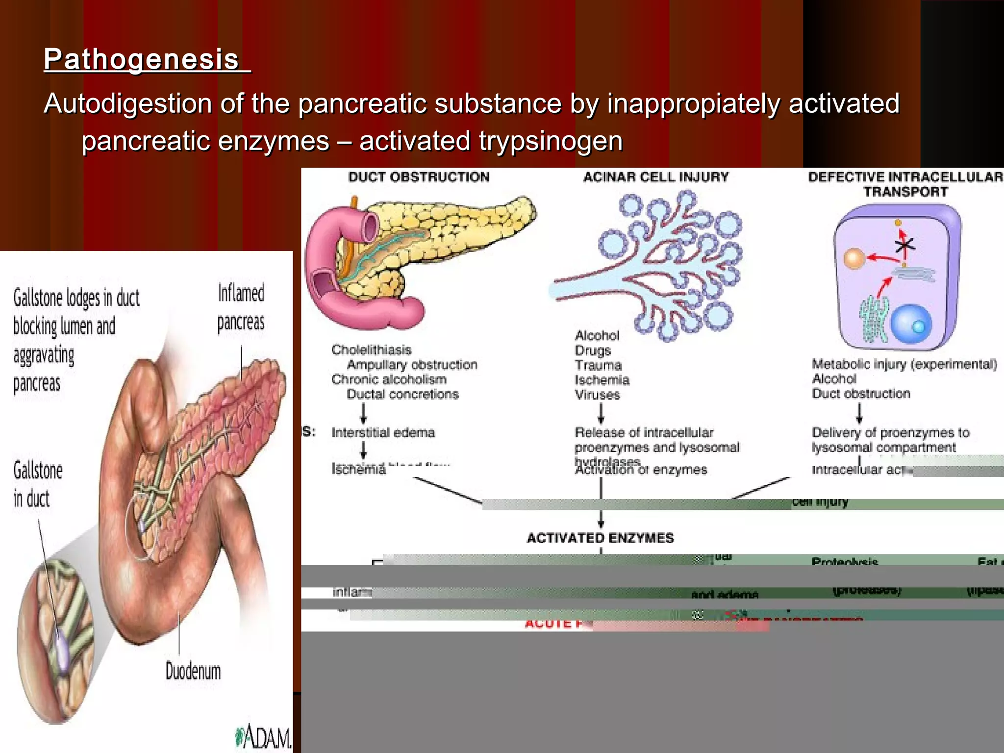 10.pancreatic pathology | PPT