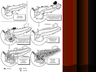 10.pancreatic pathology | PPT