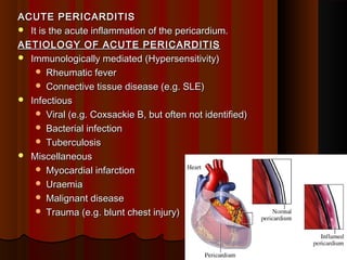 10.Diseases of pericardium | PPT