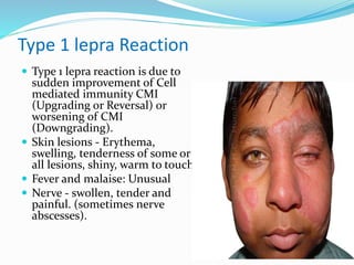 10. Leprosy | PPTX | Skin and Dermatology | Diseases and Conditions