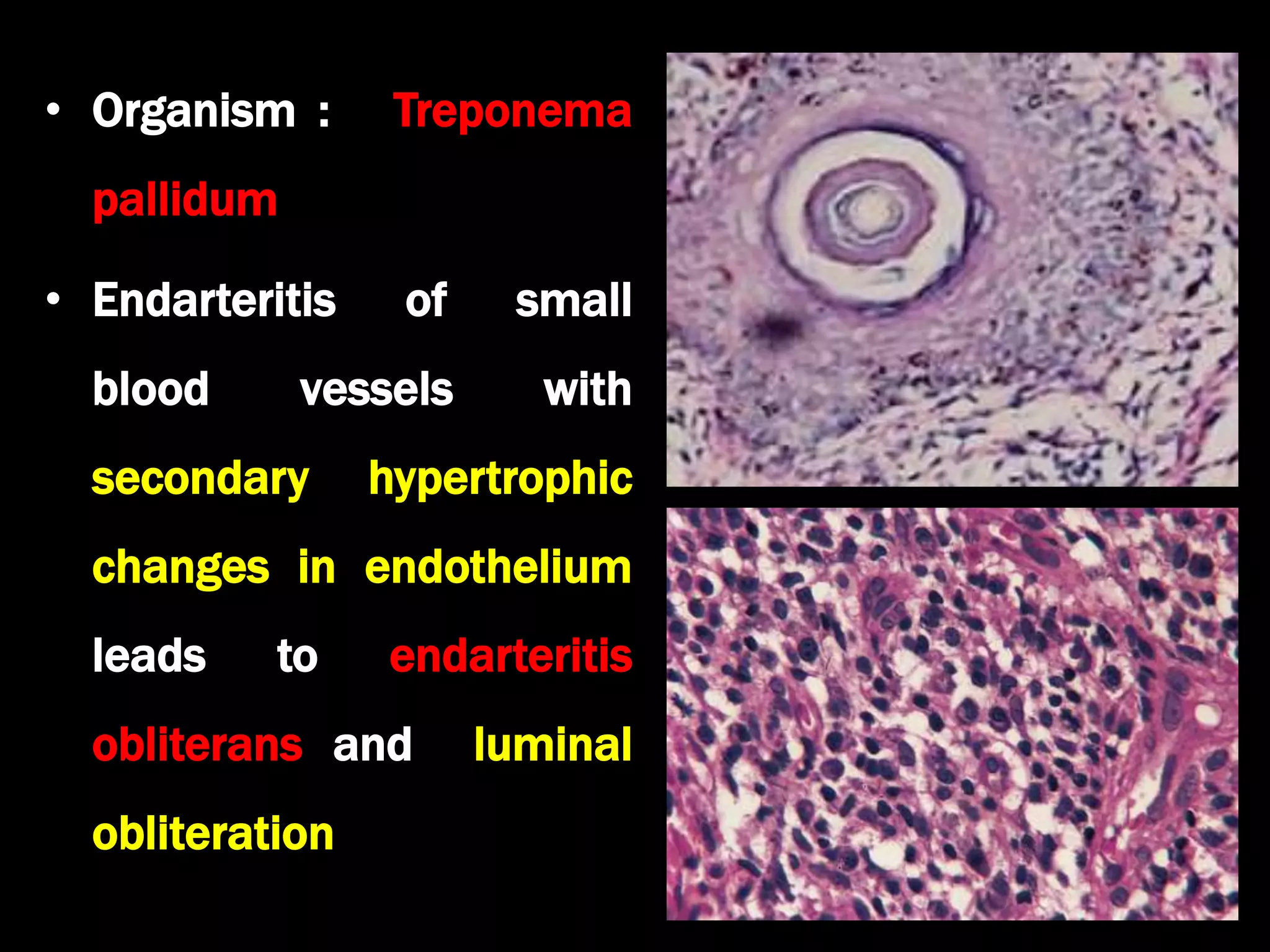 Granulomatous diseases of nose | PPT