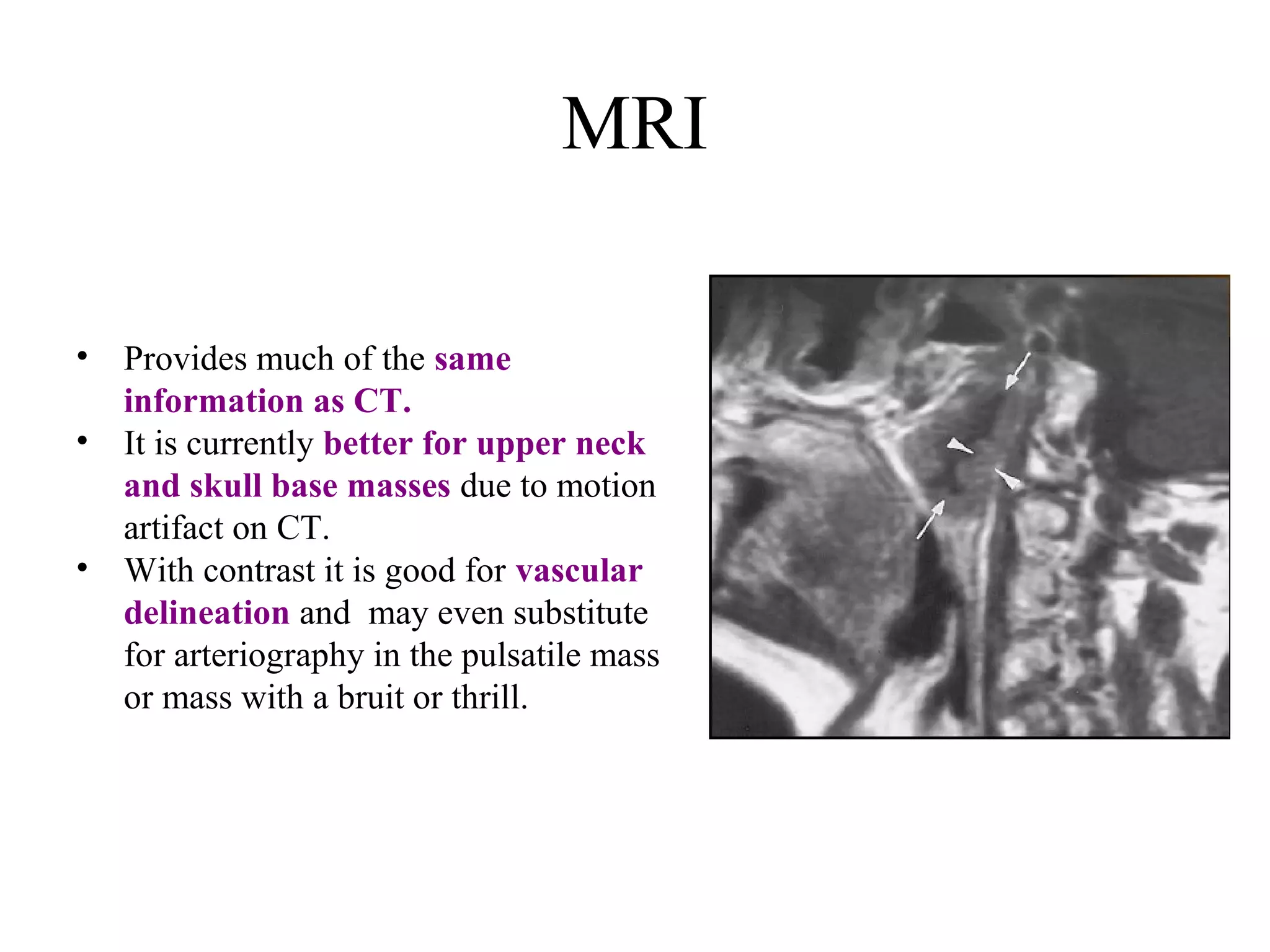 10 Neck Masses Copy Ppt
