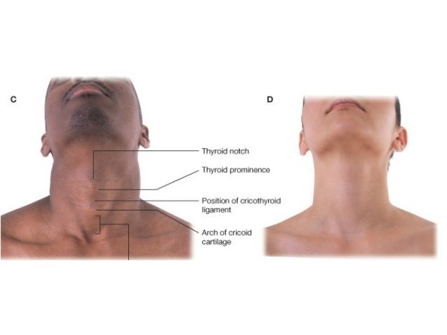 10 neck masses - copy