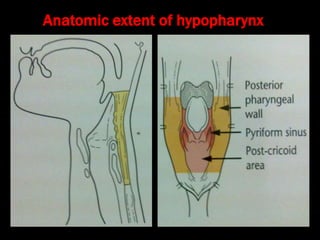 Carcinoma of hypopharynx | PPT