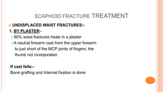 Scaphoid fracture | PPTX
