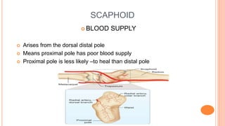Scaphoid fracture | PPTX