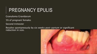 Inflammatory Overgrowths | PPTX