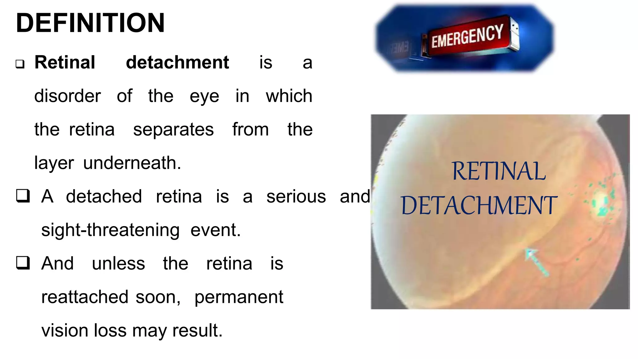 10. 1 disorders of retina | PPTX