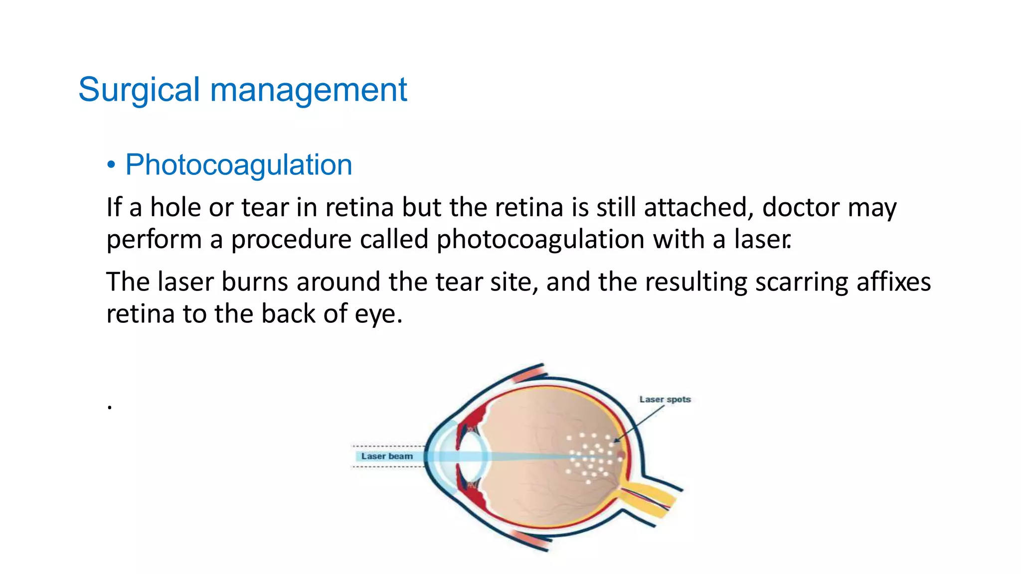 10. 1 disorders of retina | PPTX