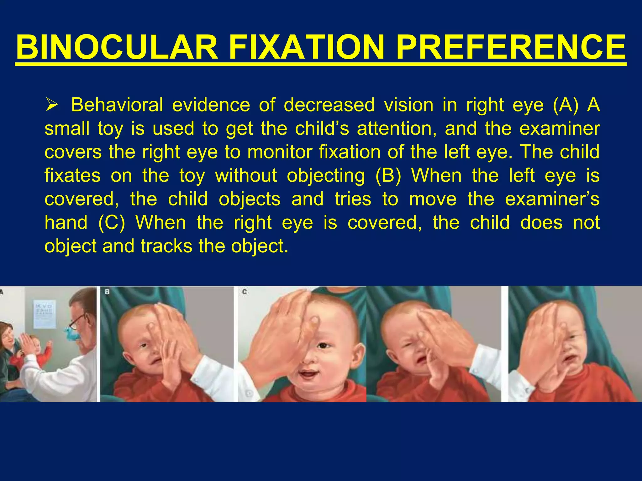 Visual acuity in children | PPT