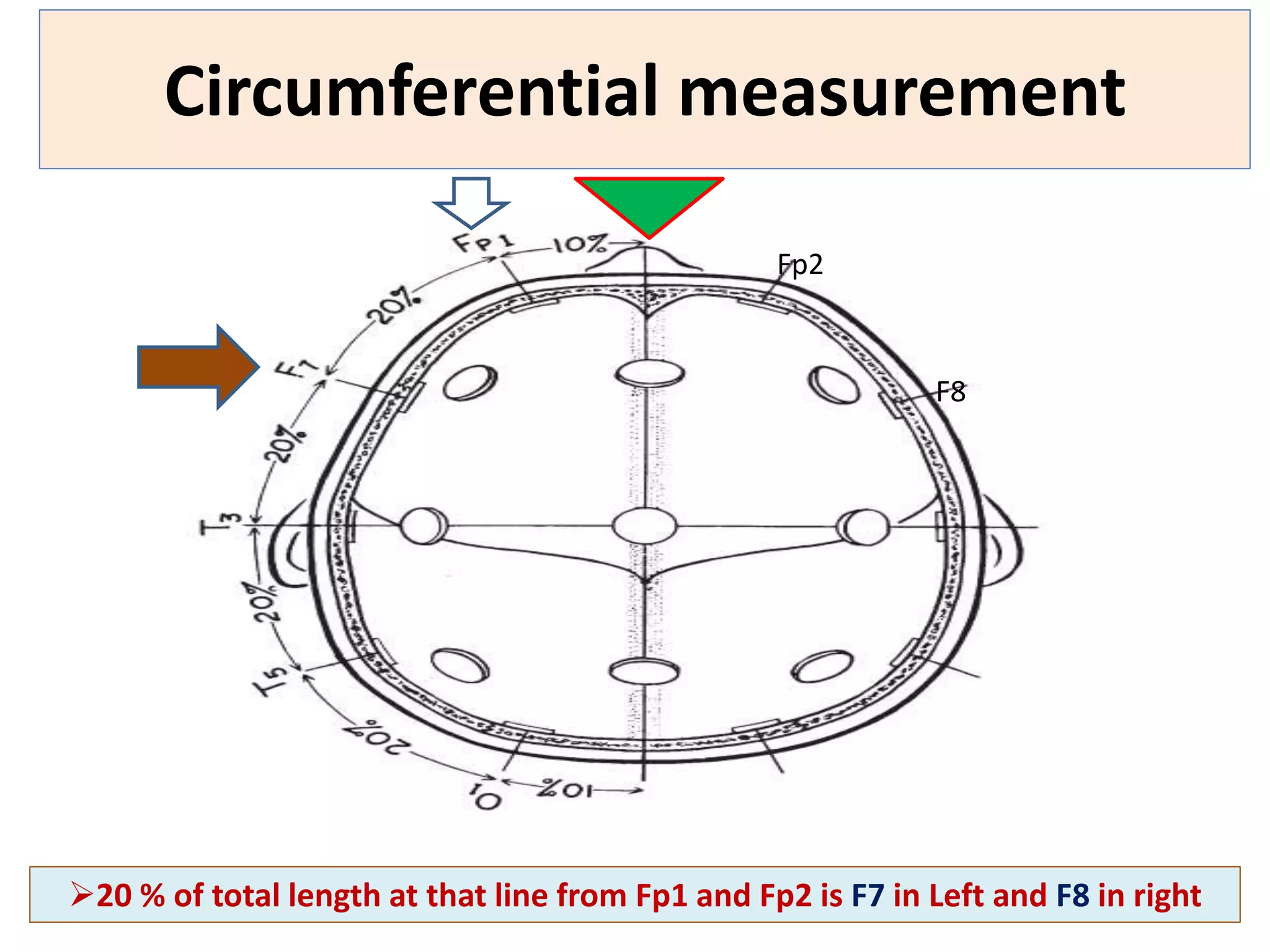 10 20 system of eeg | PPTX
