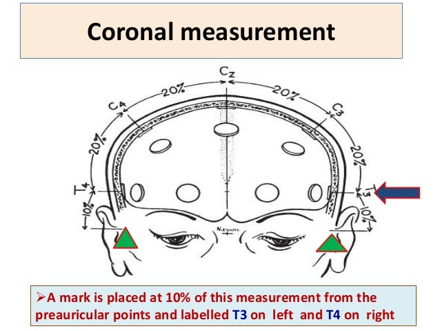 10 20 system of eeg