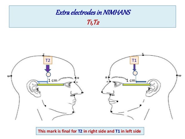 10 20 system of eeg