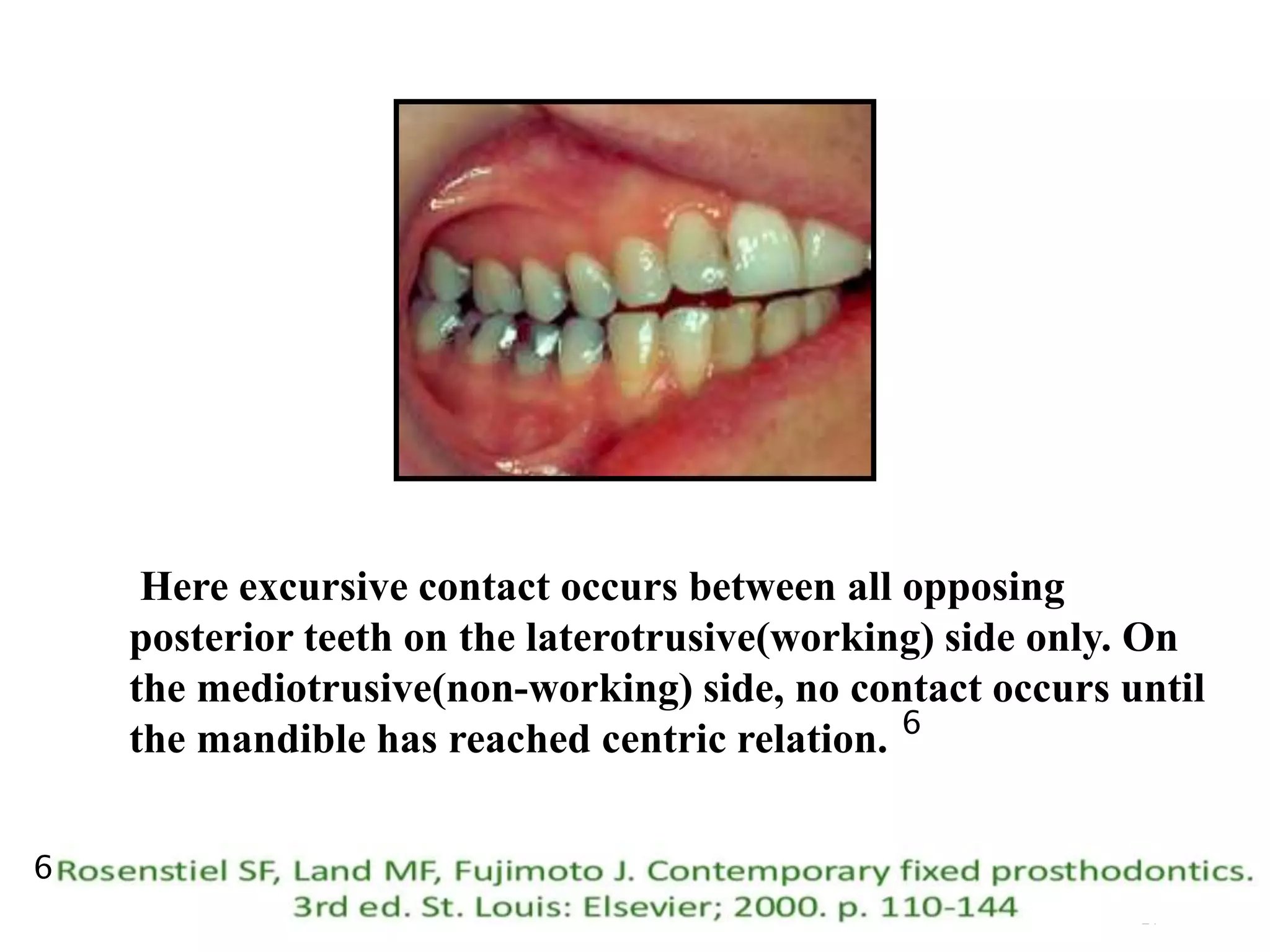 Occlusion in fpd seminar | PPTX
