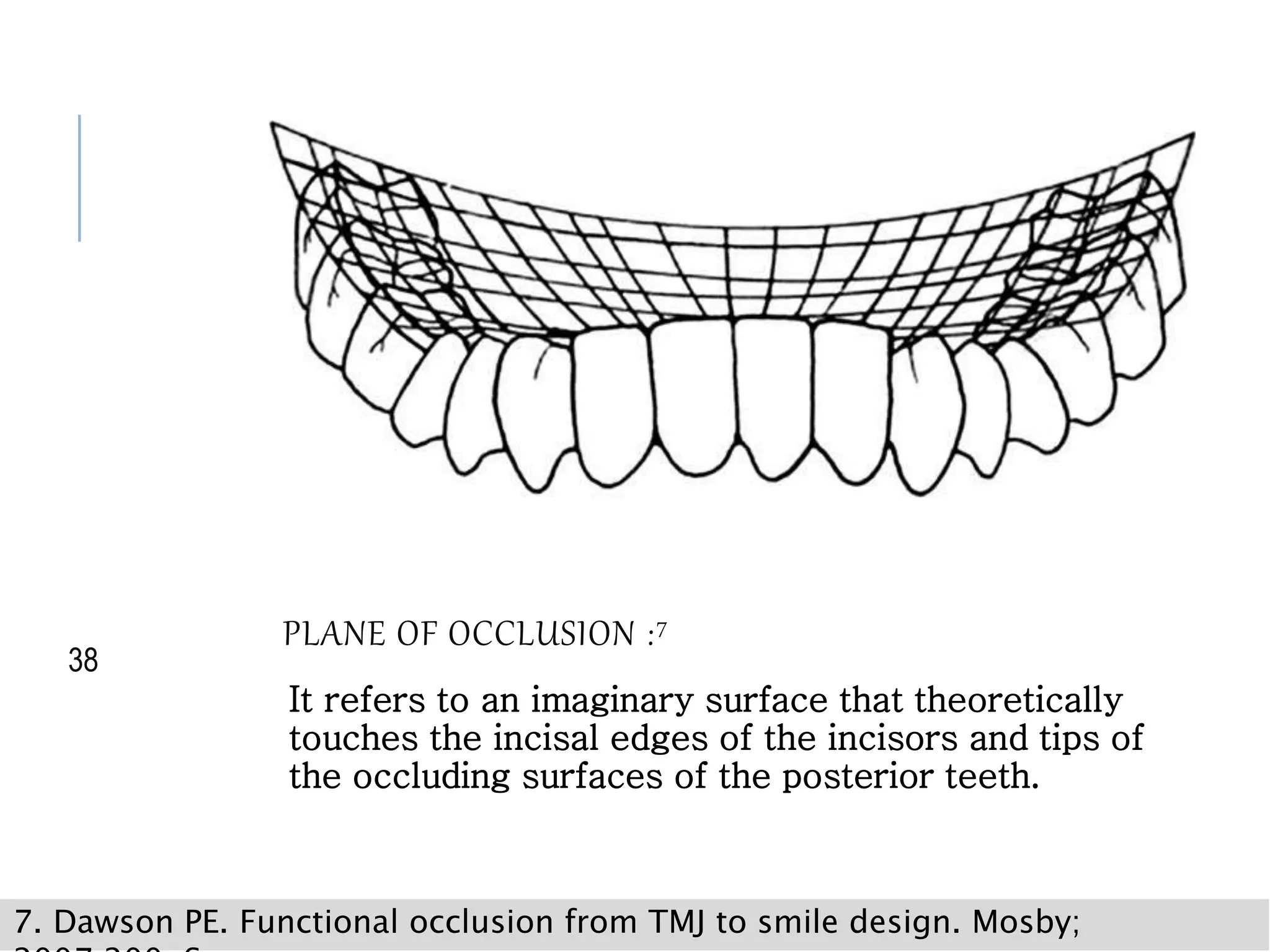 Occlusion in fpd seminar | PPTX
