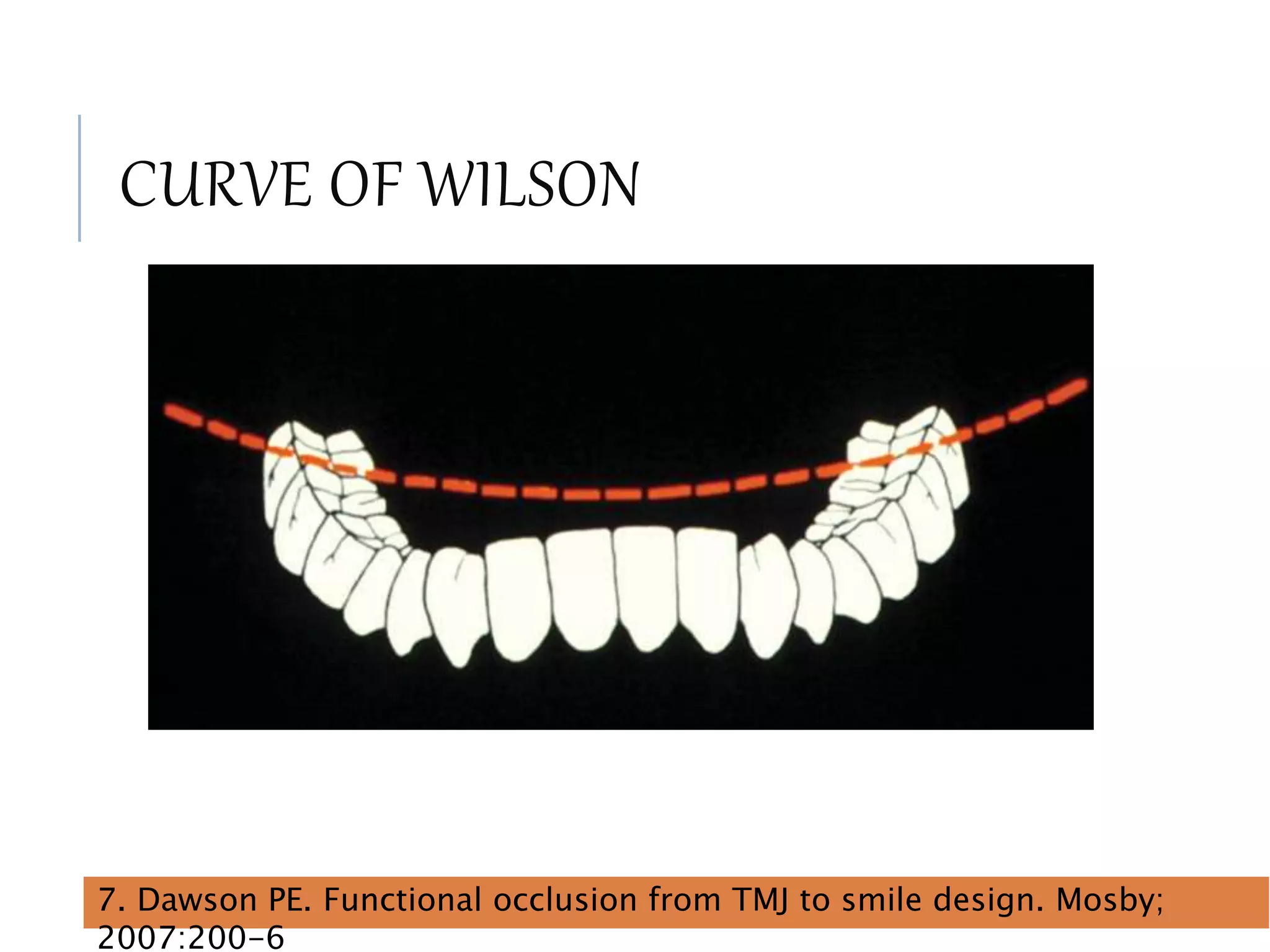 Occlusion in fpd seminar | PPTX
