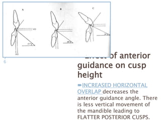 Occlusion in fpd seminar | PPTX