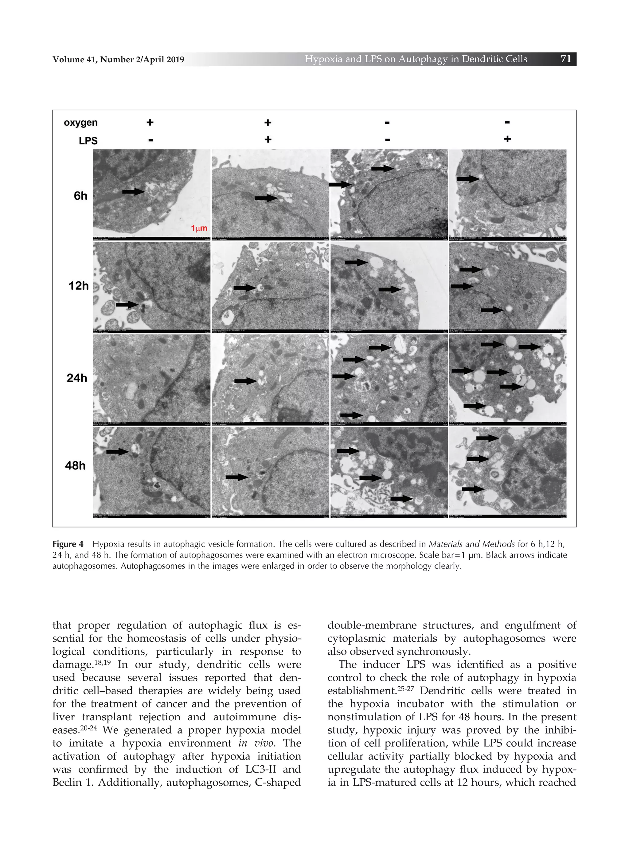 Synergy Assessment of Hypoxia and Lipopolysaccharide on Autophagy in ...