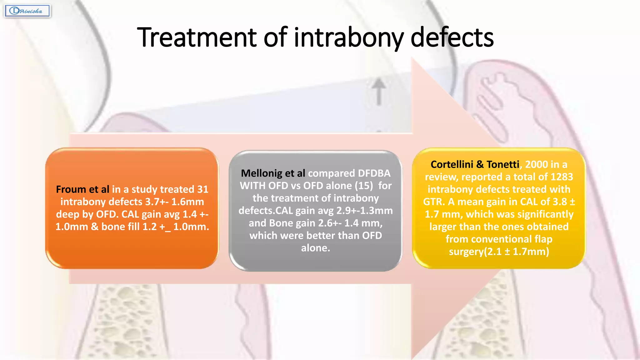 Treatment of Infrabony Pockets.pptx