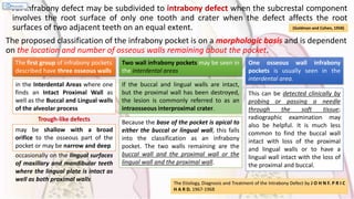 Treatment of Infrabony Pockets.pptx