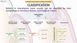 Treatment of Infrabony Pockets.pptx