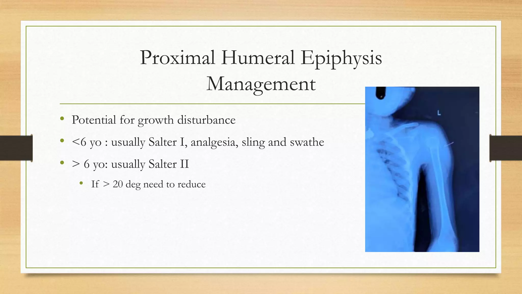Humerus Fractures | PPTX