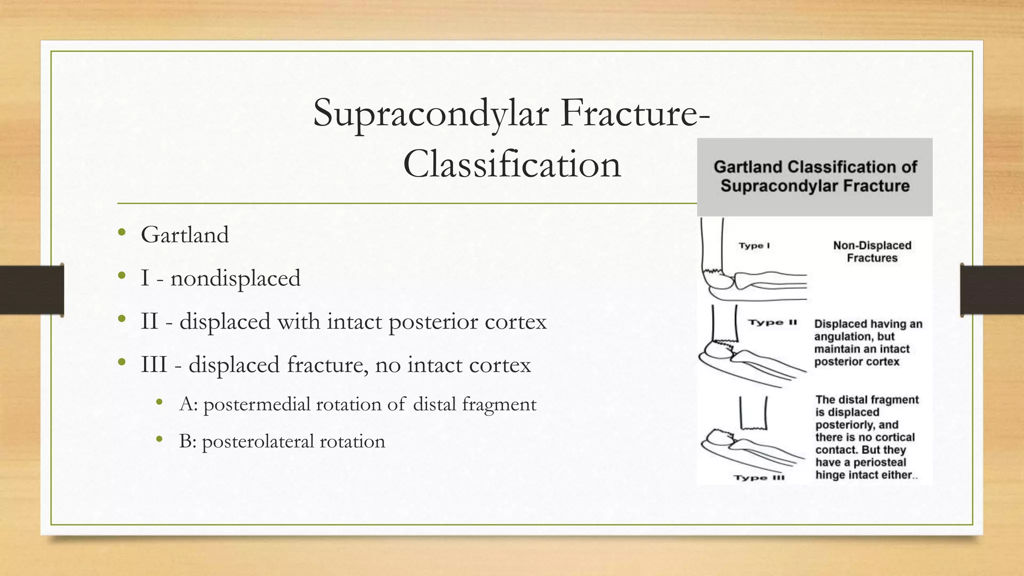 Humerus Fractures | PPTX