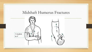 Humerus Fractures | PPTX