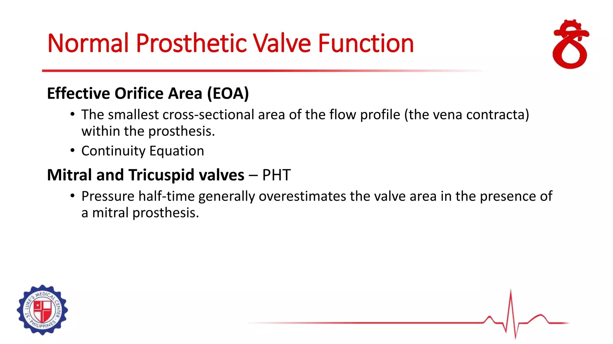 10.8.21 ECHO Normal prosthetic valve - FLOREN.pptx