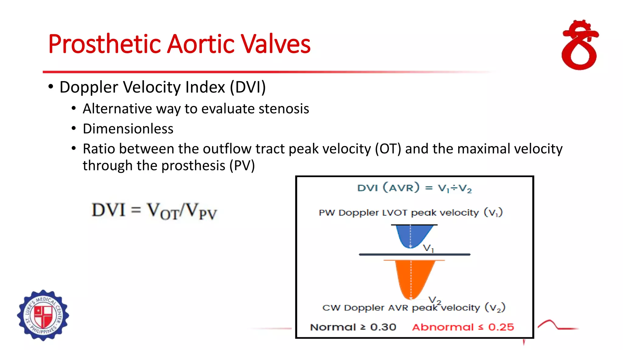 10.8.21 ECHO Normal prosthetic valve - FLOREN.pptx